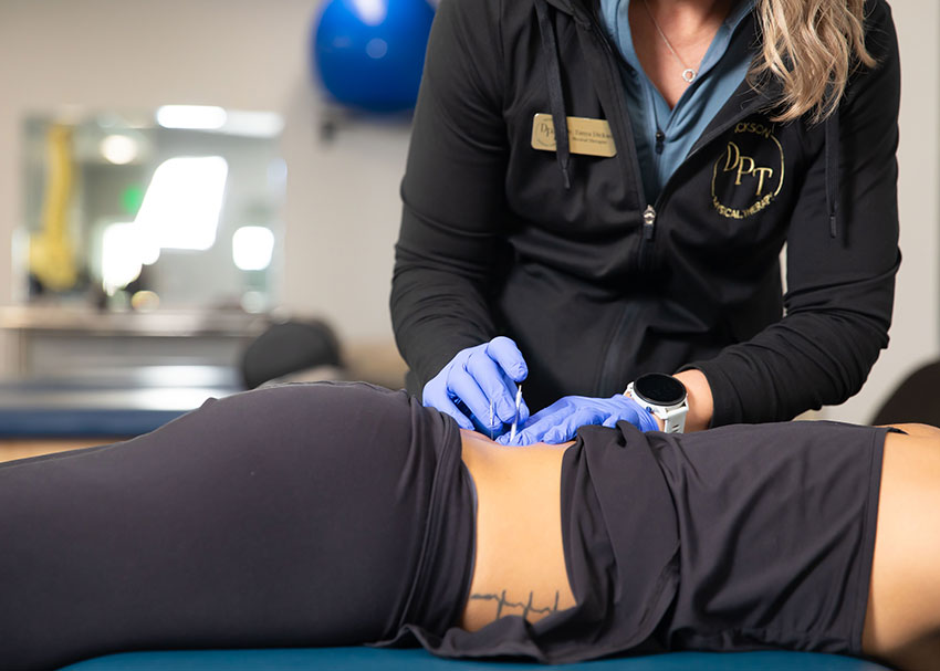 Dry Needling – Dickson Physical Therapy